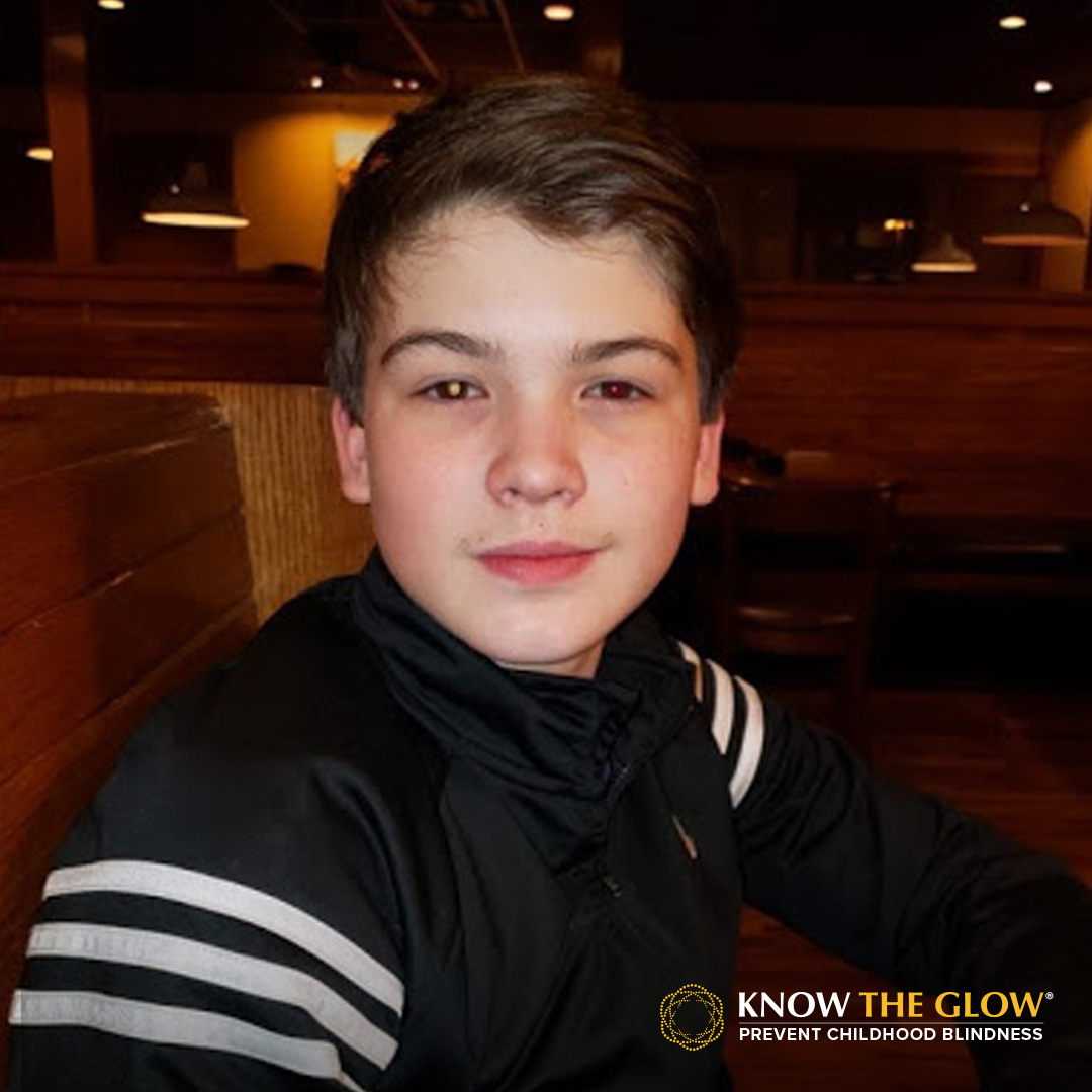 Glow Image Gallery - Know The Glow